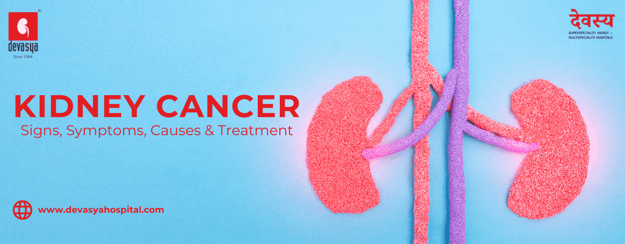 Kidney Cancer: Signs, Symptoms, Causes and Treatment